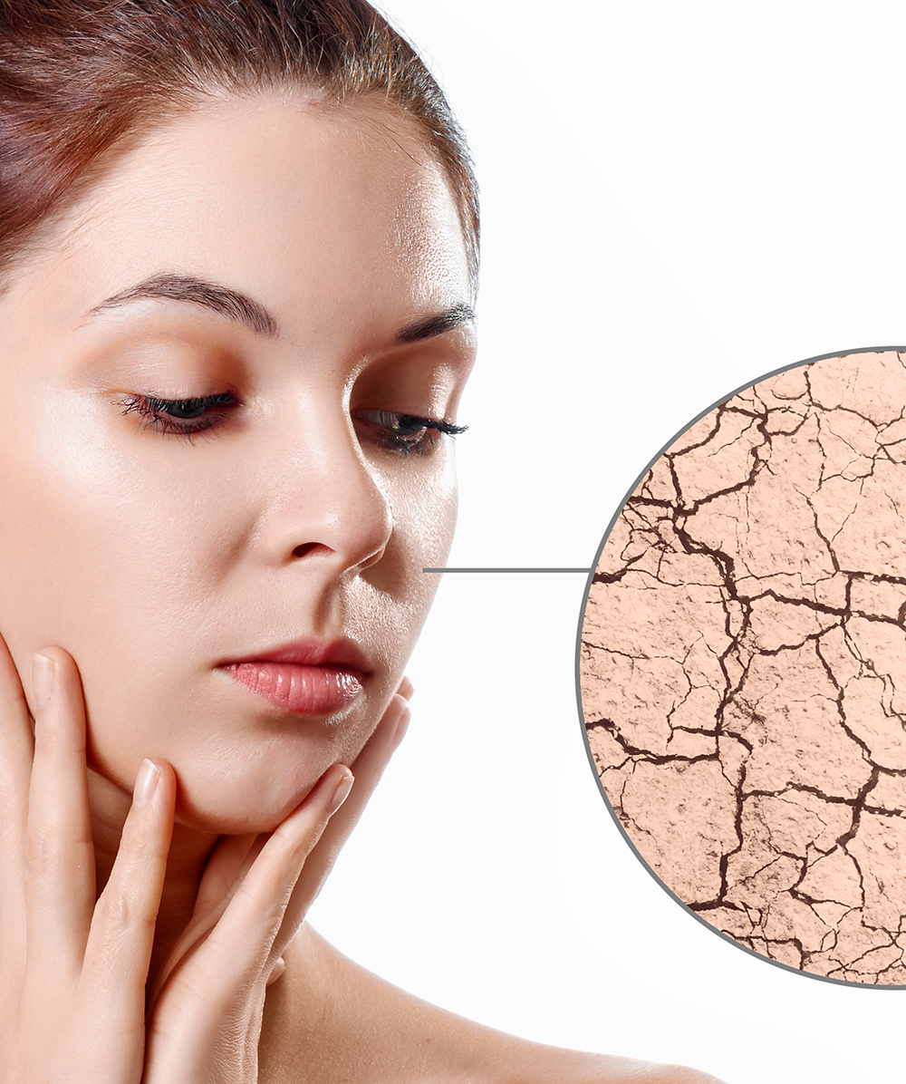 Identifying your skin type - Storme Makeup and Hair